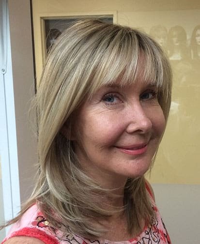 Wigs for Alopecia Patients | Alopecia Wig | Wigs Miami